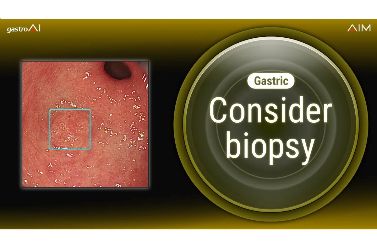 ASCII.jp：AIメディカルサービス、AIによる内視鏡画像診断支援ソフトの製造販売承認を取得