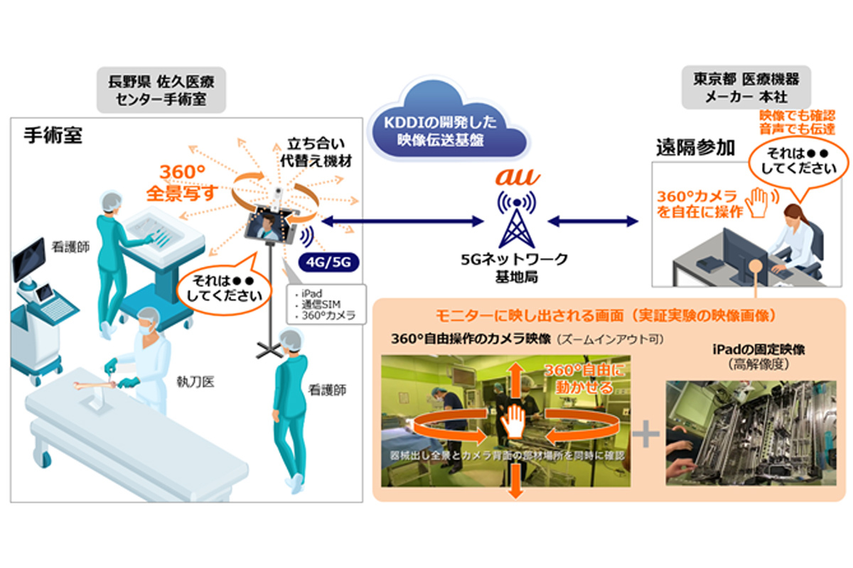 ASCII.jp：KDDI、5G通信で360度映像をリアルタイム伝送し手術に遠隔参加